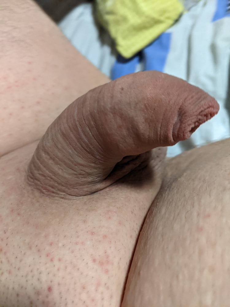 Cock Pictures 22 Im So Horny 45 Pics Xhamster