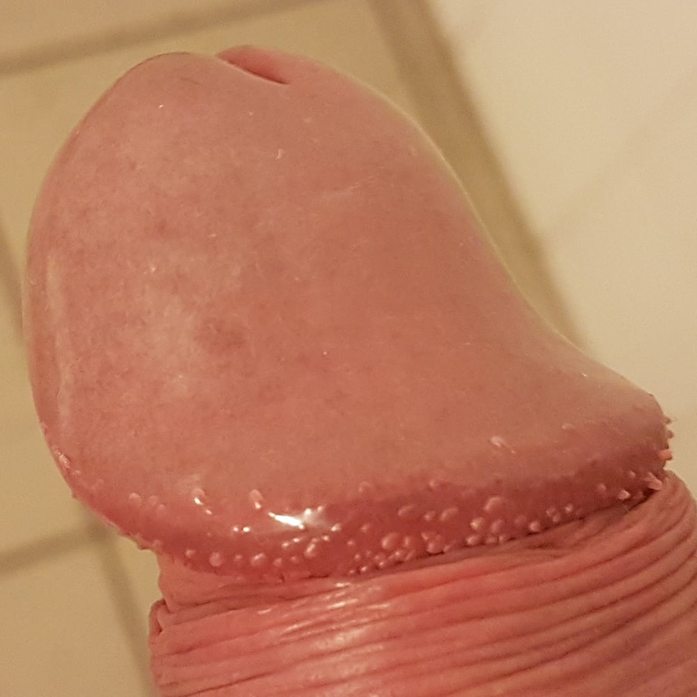 Gland 26 Pics Xhamster