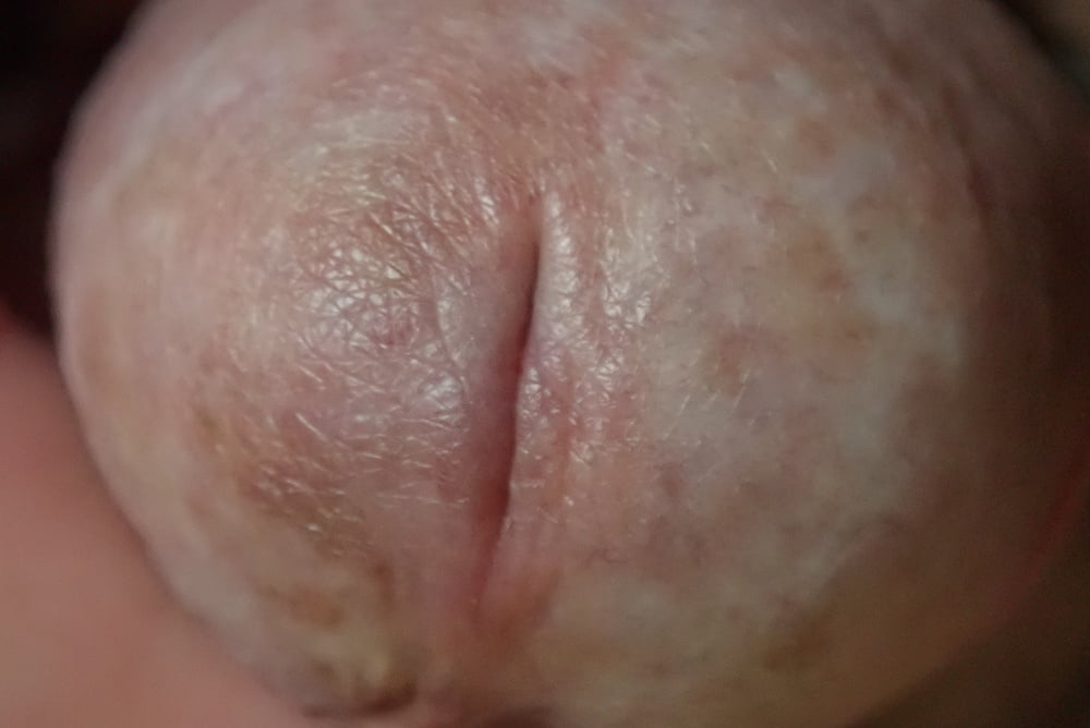 Close Up Penis 14 Pics Xhamster